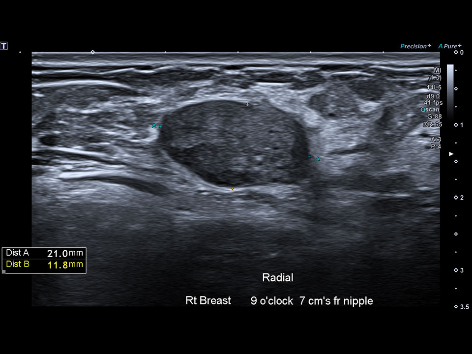 Small Parts Aplio I series Clinical Gallery Ultrasound Canon