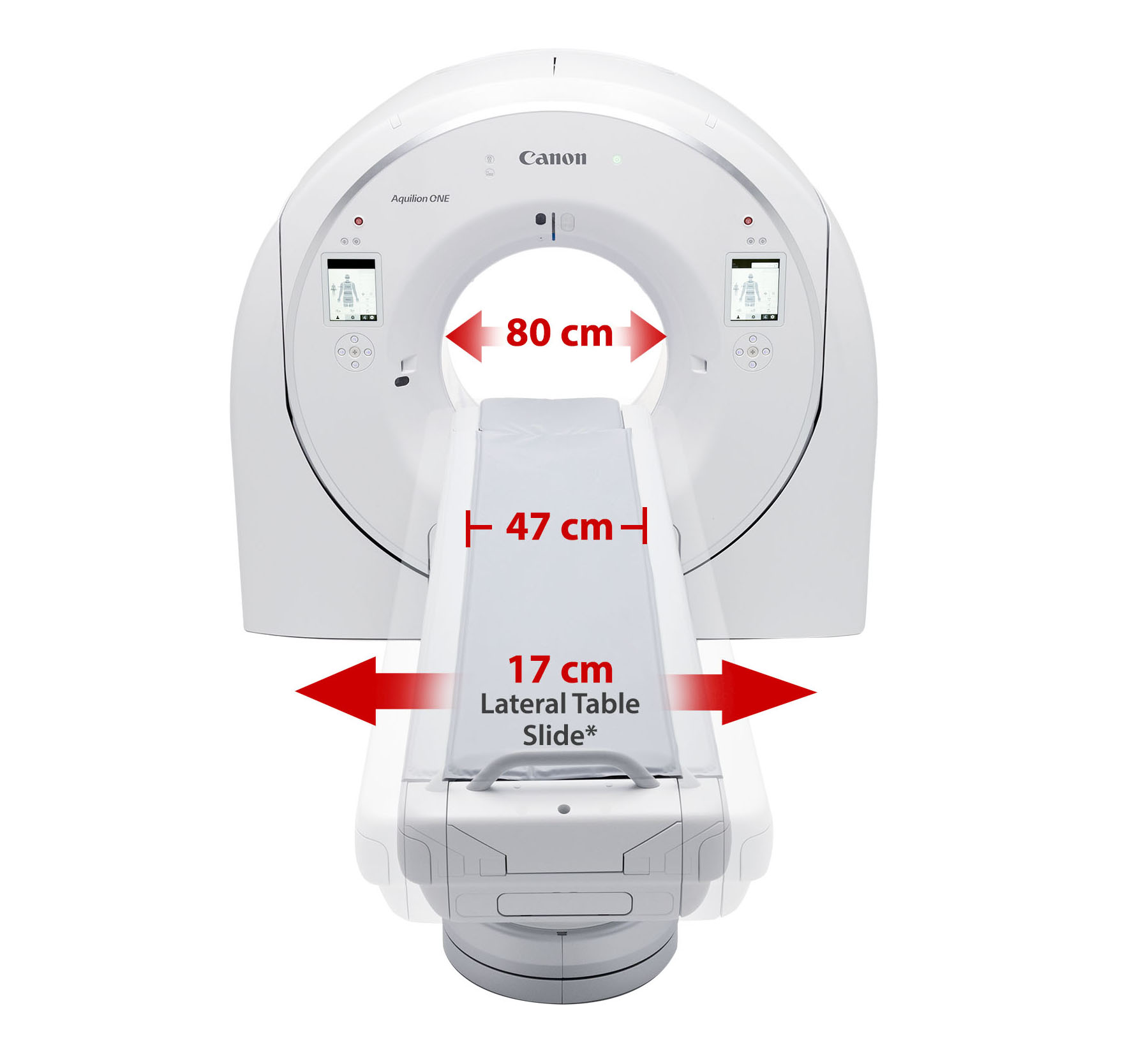 Technology | Aquilion ONE / INSIGHT Edition | Computed Tomography | CT ...
