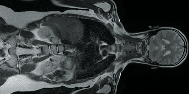 Auto Scan Assist | Technologies | MRI | Magnetic Resonance Imaging ...