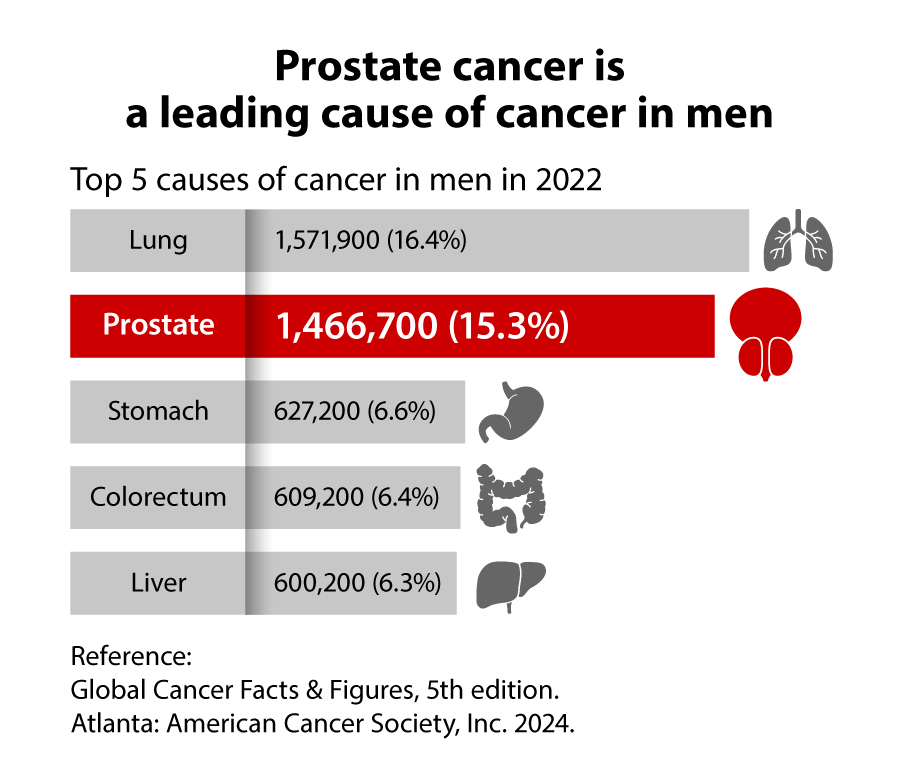 Prostate cancer is a leading cause of cancer in men